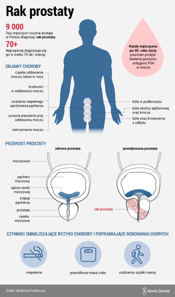 15 września ? Europejski Dzień Prostaty – Szpital